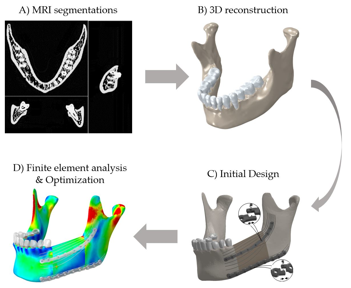 Bioengineering | Free Full-Text | Fixation Release and the Bone Bandaid ... Bioengineering | Free Full-Text | Fixation Release and the Bone Bandaid ...