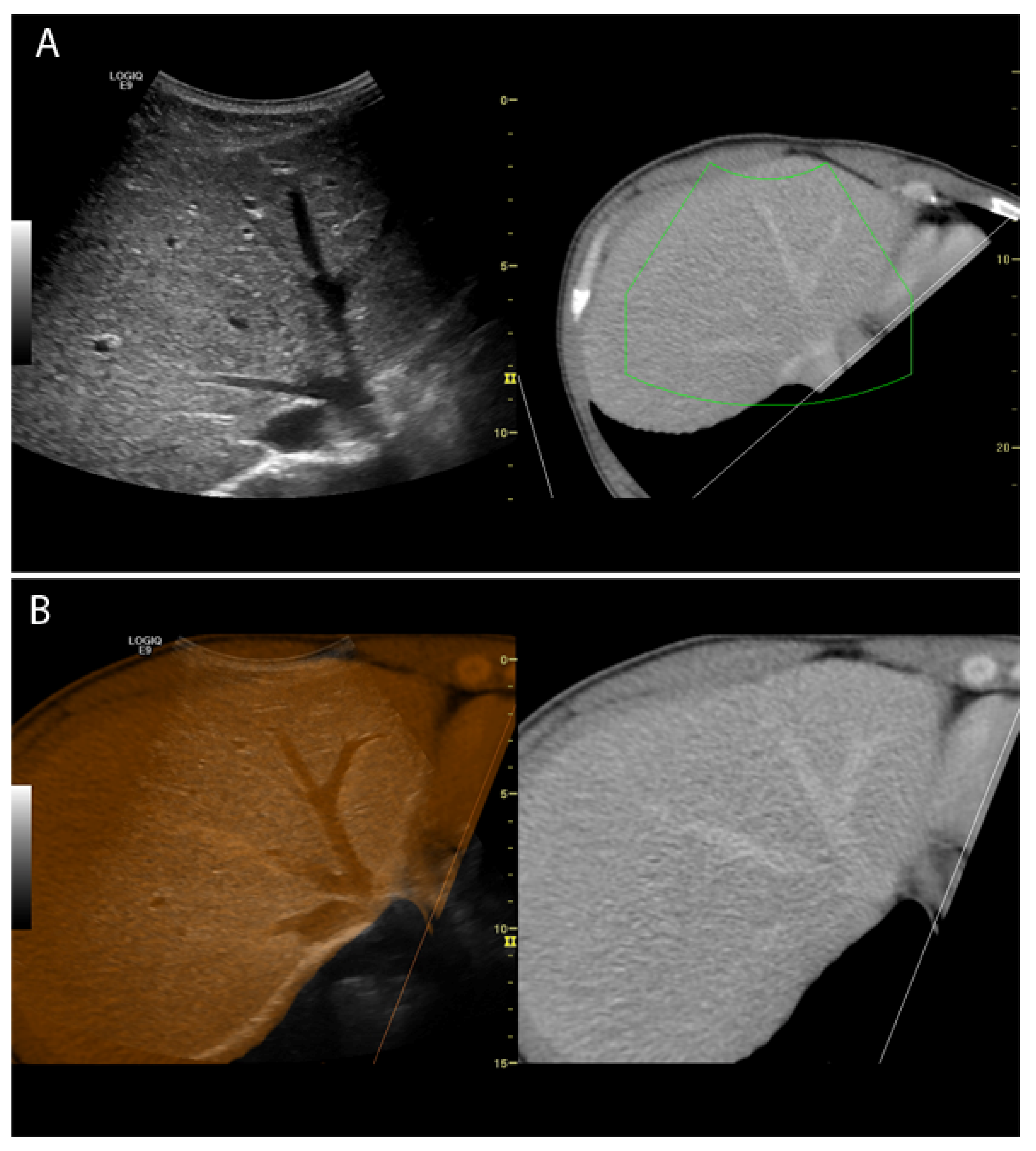 Diagnostics | Free Full-Text | Improving Accuracy for Image Fusion in ... Diagnostics | Free Full-Text | Improving Accuracy for Image Fusion in ...