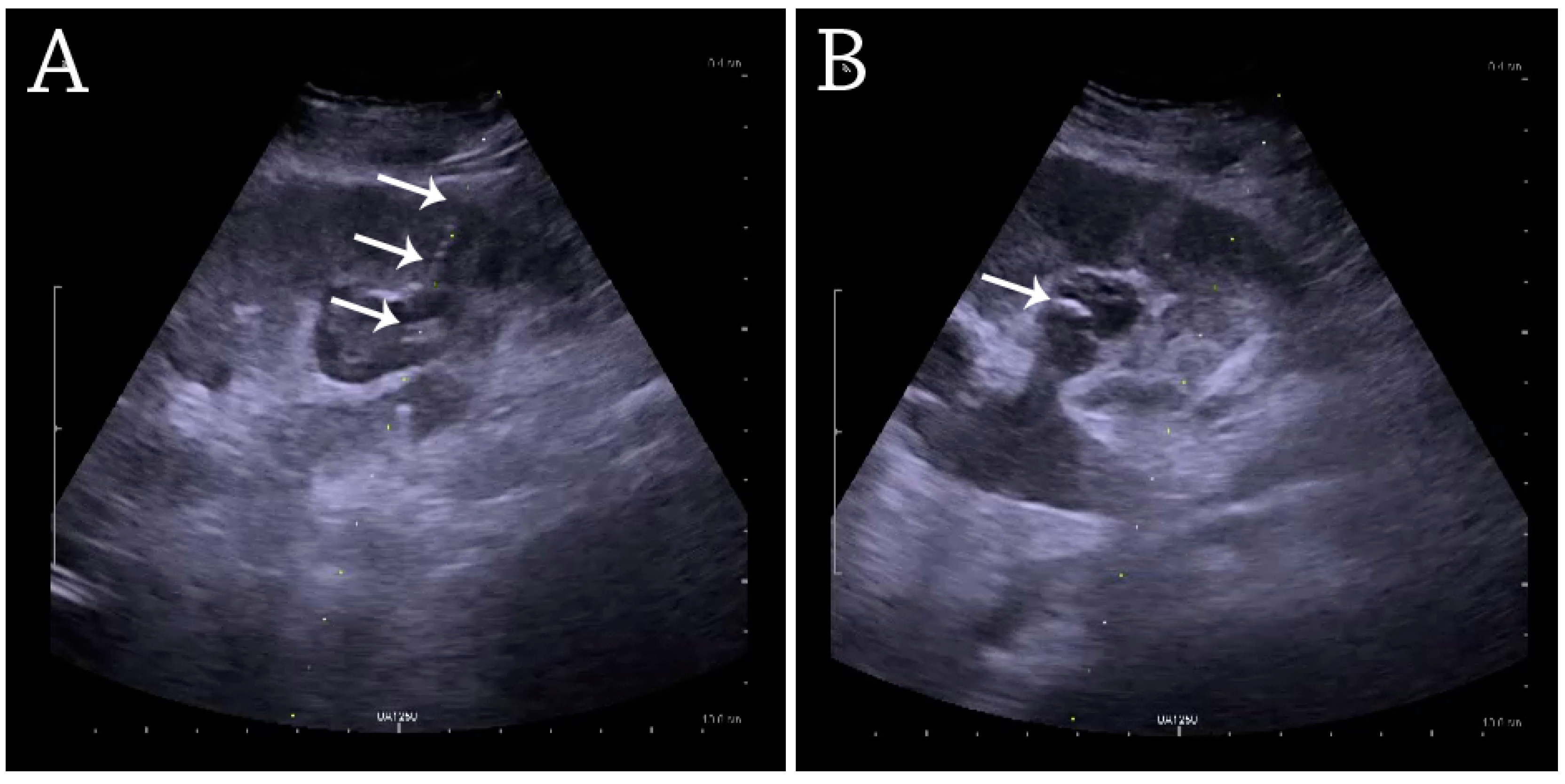 Diagnostics | Free Full-Text | Ultrasonography of the Kidney: A ... Diagnostics | Free Full-Text | Ultrasonography of the Kidney: A ...