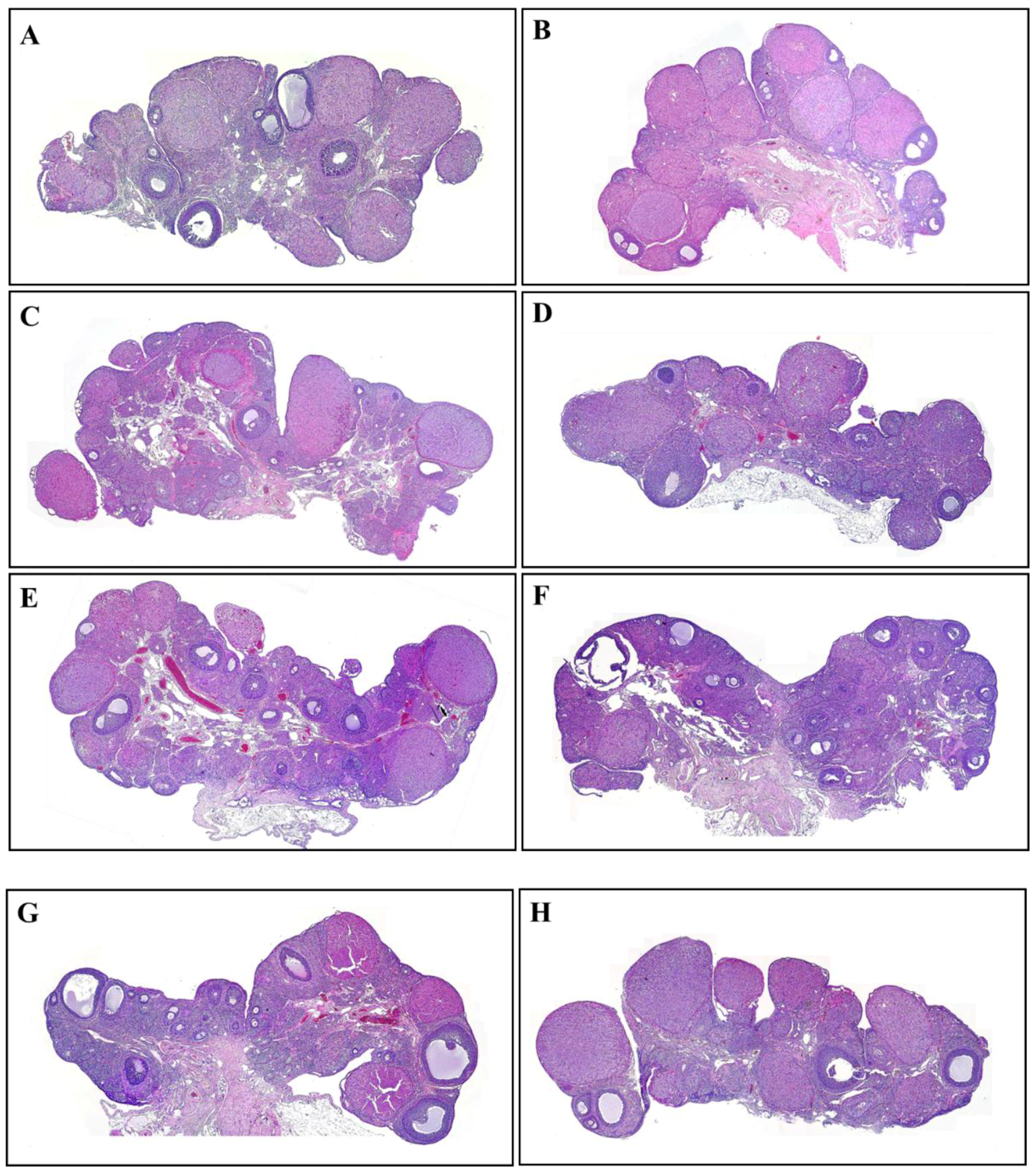 Ijerph Free Full Text Parabens Accelerate Ovarian Dysfunction In A