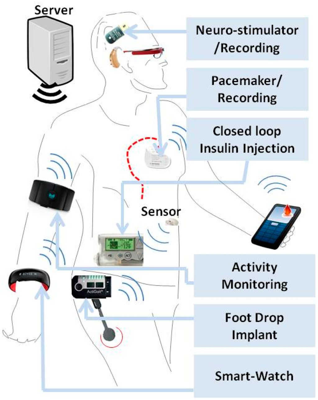 Sensors | Free Full-Text | Wireless Integrated Biosensors for Point-of ... Sensors | Free Full-Text | Wireless Integrated Biosensors for Point-of ...