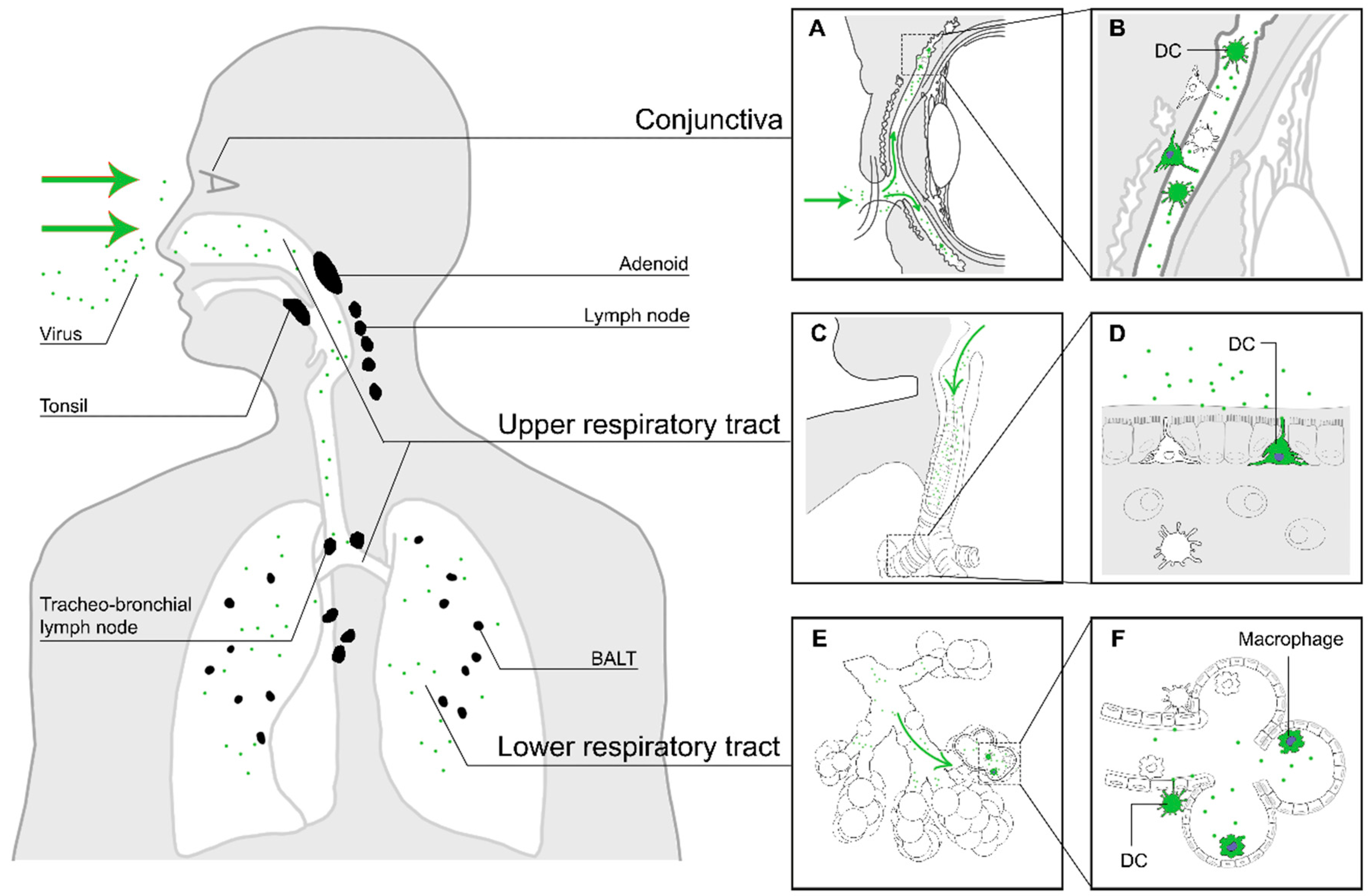 Viruses | Free Full-Text | Measles Virus Host Invasion and Pathogenesis Viruses | Free Full-Text | Measles Virus Host Invasion and Pathogenesis