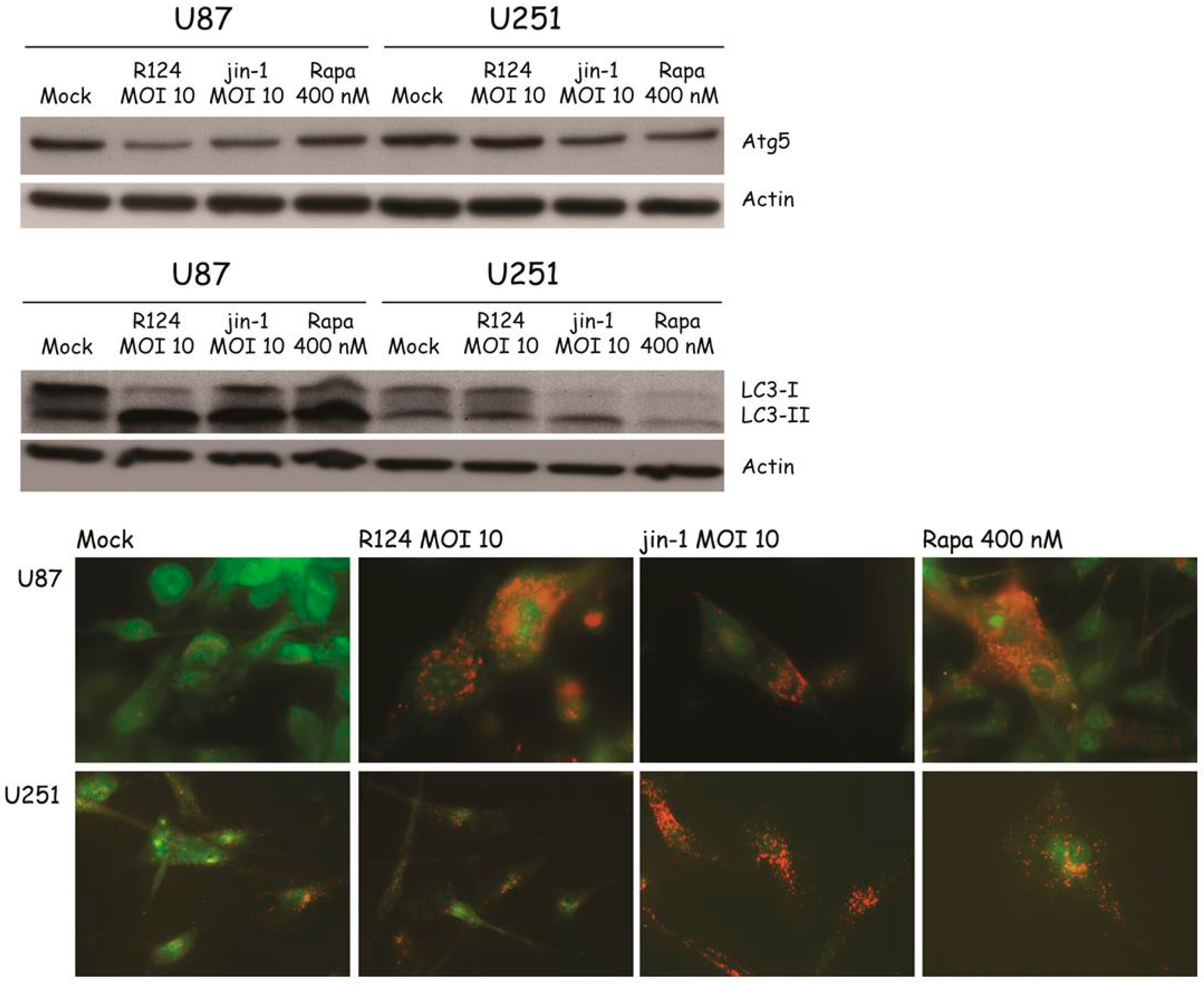 Viruses | Free Full-Text | Oncolytic Reovirus Infection Is Facilitated ... Viruses | Free Full-Text | Oncolytic Reovirus Infection Is Facilitated ...