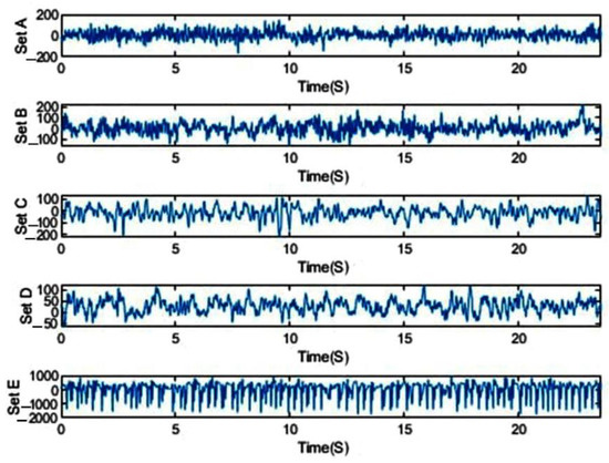 Bdcc Free Full Text Automatic Diagnosis Of Epileptic Seizures In Eeg Signals Using Fractal