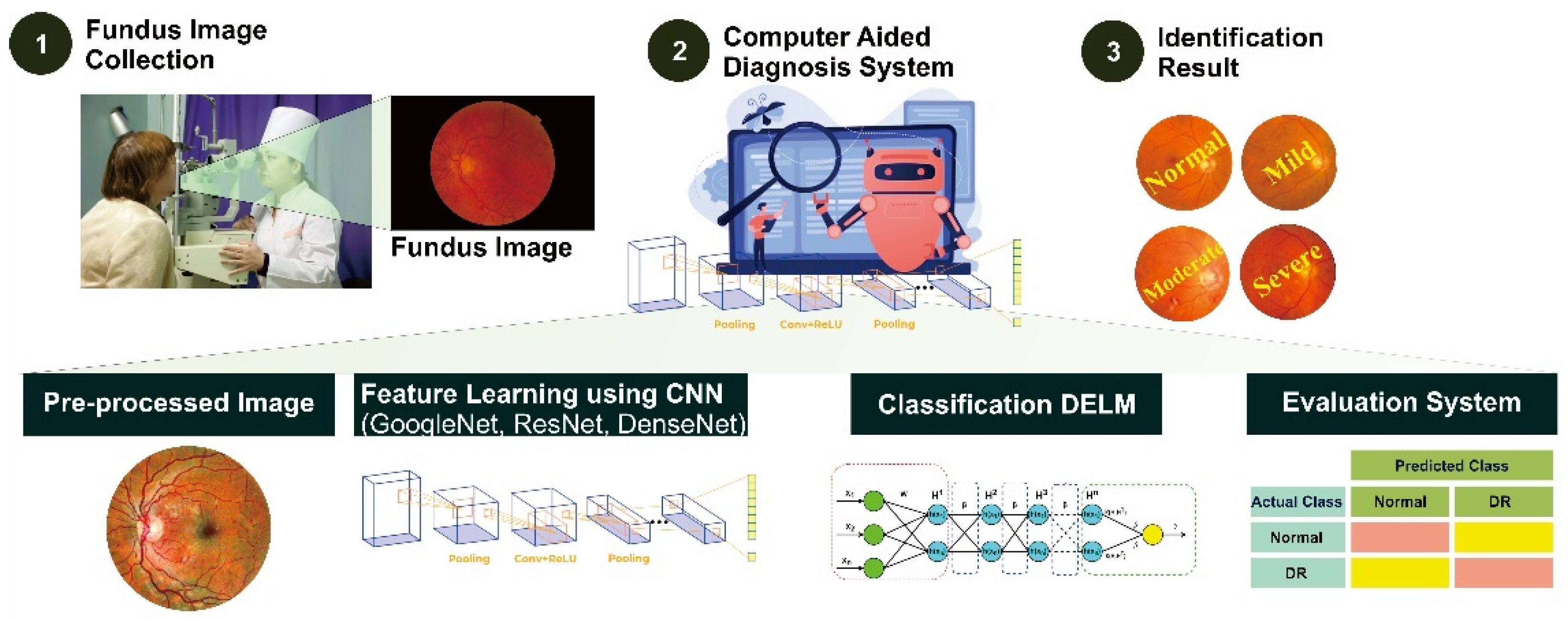Image Fundus Classification System for Diabetic Retinopathy Stage Detection Using Hybrid CNN-DELM