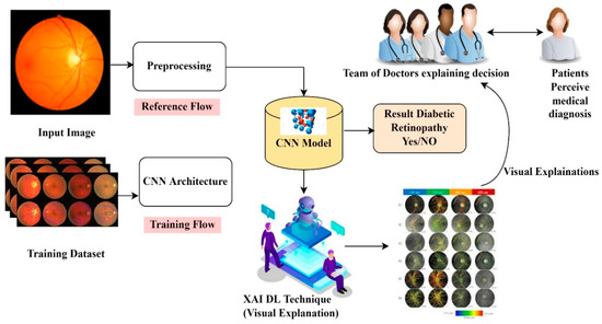 A Systematic Literature Review on Diabetic Retinopathy Using an Artificial Intelligence Approach