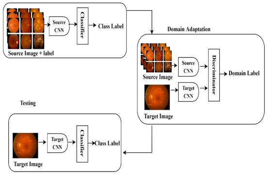 A Systematic Literature Review on Diabetic Retinopathy Using an ...