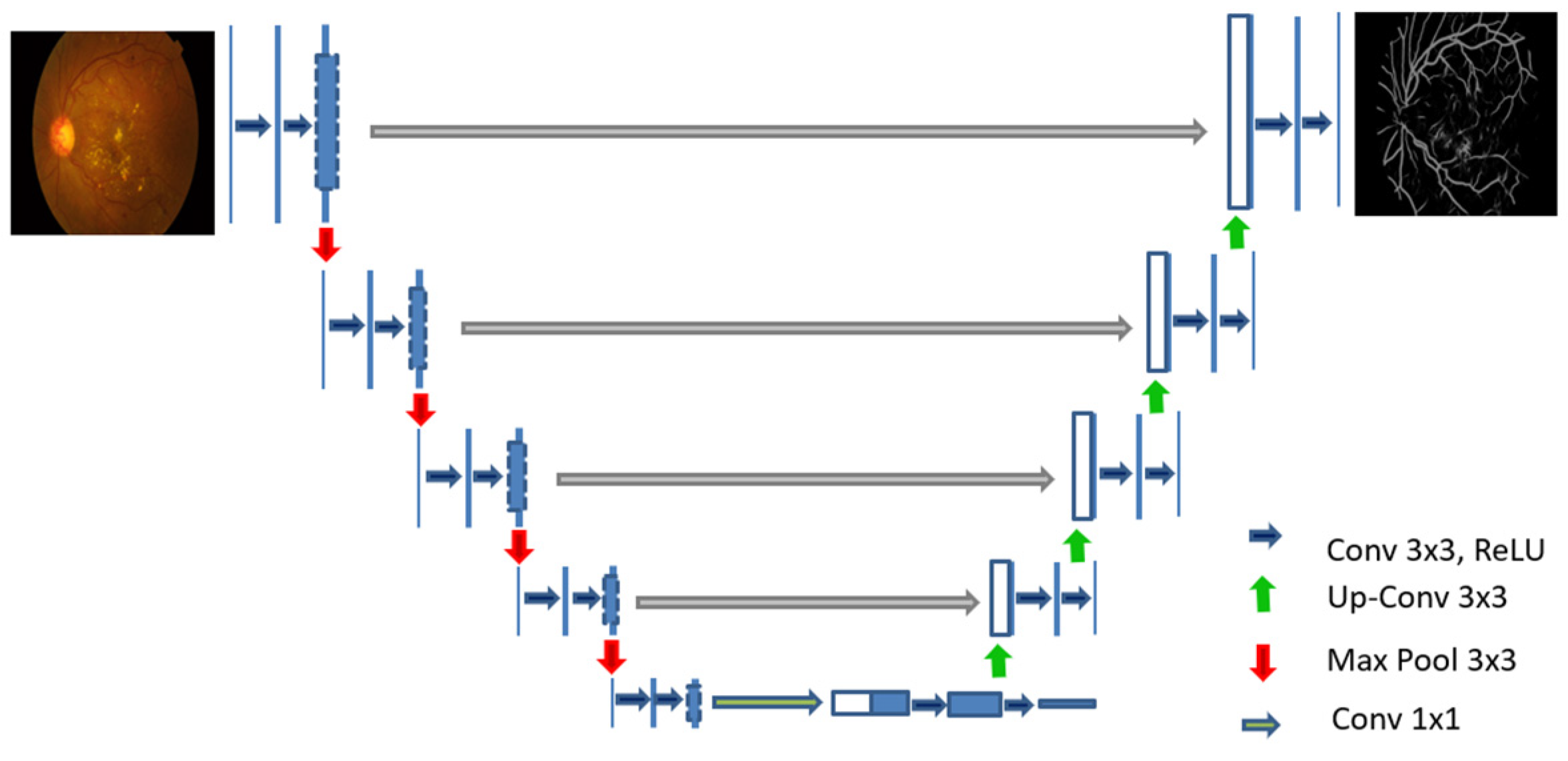BDCC | Free Full-Text | A Novel Approach for Diabetic Retinopathy Screening Using Asymmetric ...