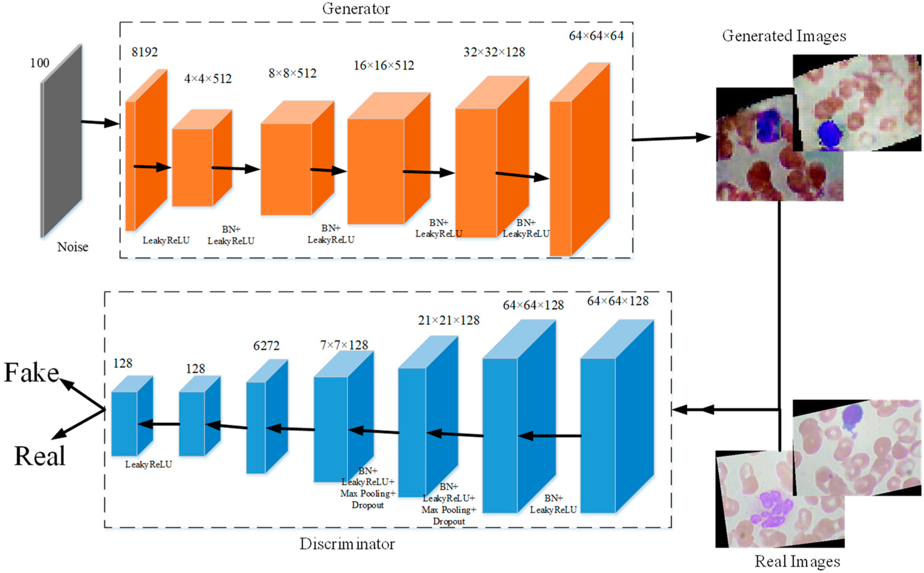 DLBCNet: A Deep Learning Network for Classifying Blood Cells