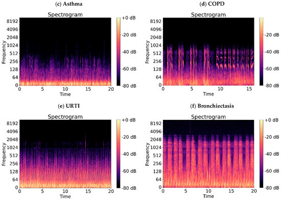 Classification and Recognition of Lung Sounds Using Artificial ...
