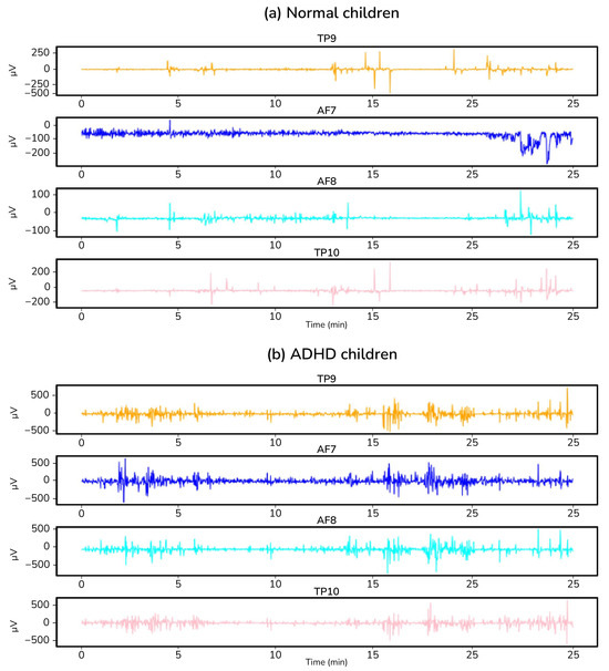 DETEC-ADHD: A Data-Driven Web App for Early ADHD Detection Using Machine Learning and ...