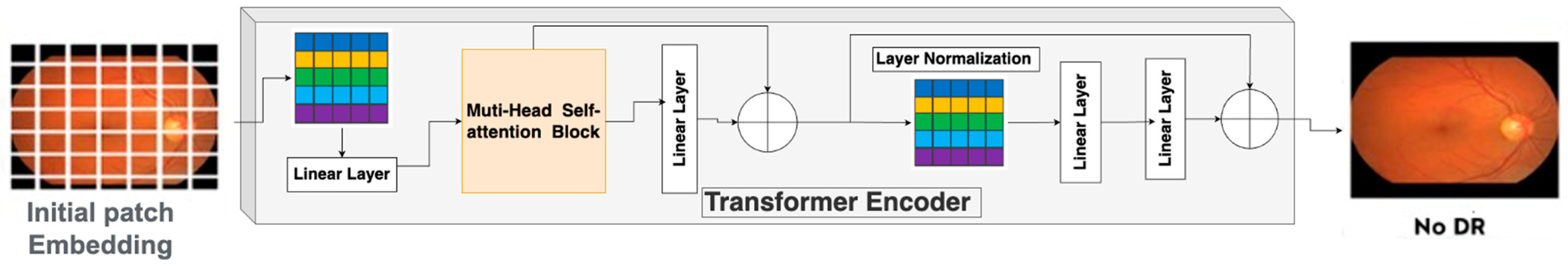 DRCCT: Enhancing Diabetic Retinopathy Classification with a Compact Convolutional Transformer