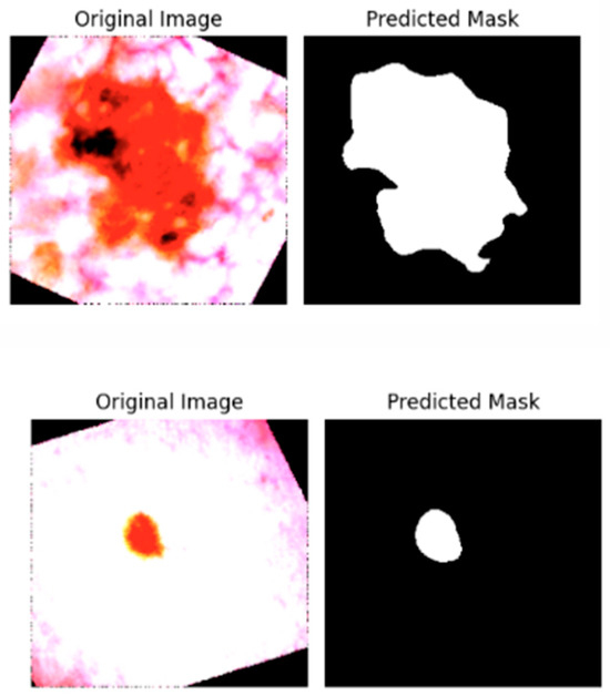 Deep Learning for Early Skin Cancer Detection: Combining Segmentation ...