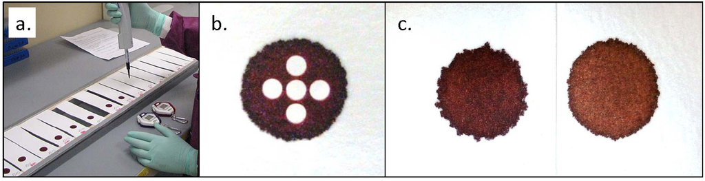 Influence of Hematocrit and Total-Spot Volume on Performance ...