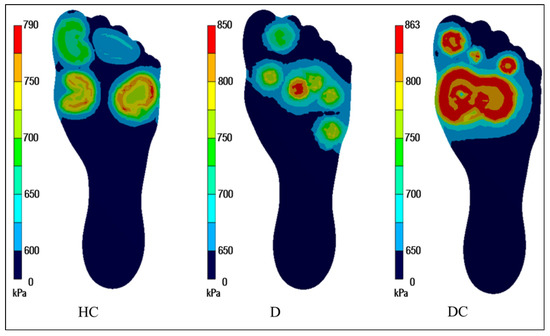 Diabot: Development of a Diabetic Foot Pressure Tracking Device