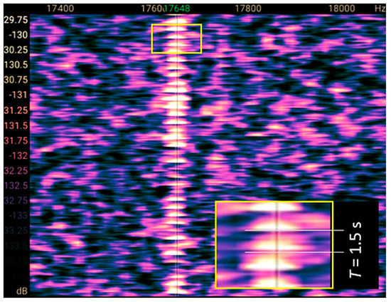 Acoustics | Free Full-Text | Exposure to High-Frequency Sound and ...