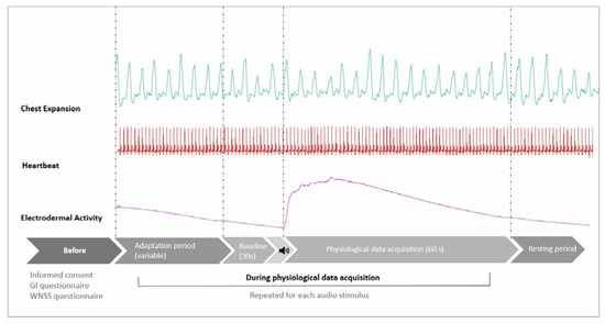 Effects of Industrial Noise on Physiological Responses
