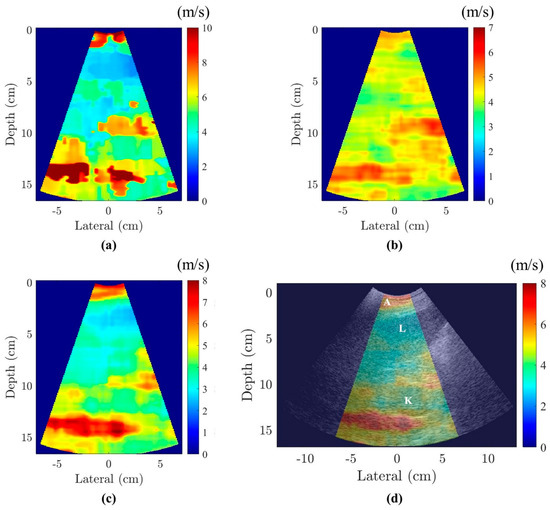 Angular Integral Autocorrelation for Speed Estimation in Shear-Wave Elastography