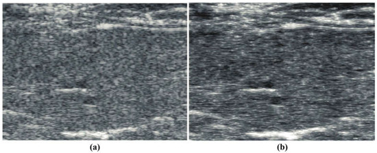 A Power Law Reconstruction of Ultrasound Backscatter Images