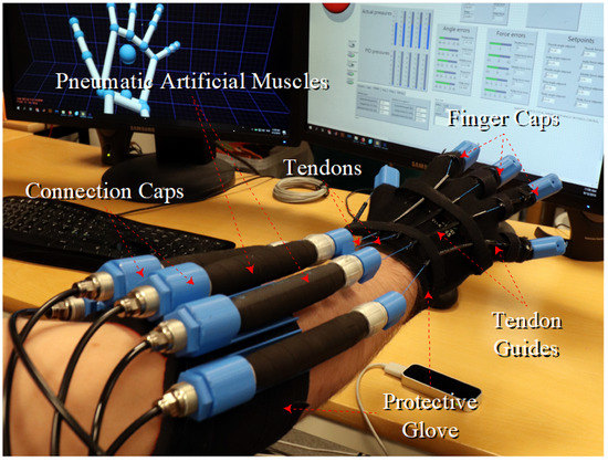 Towards Essential Hand Tremor Suppression via Pneumatic Artificial Muscles