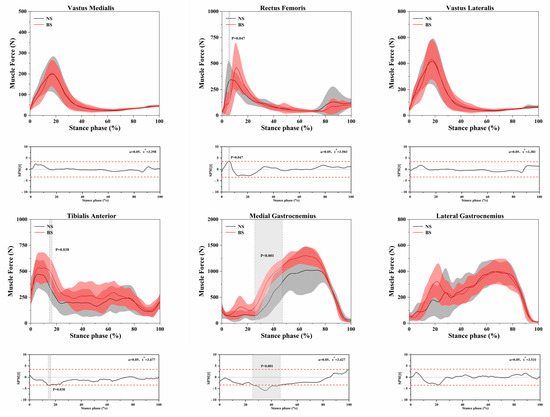 A Pilot Study of Muscle Force between Normal Shoes and Bionic Shoes ...