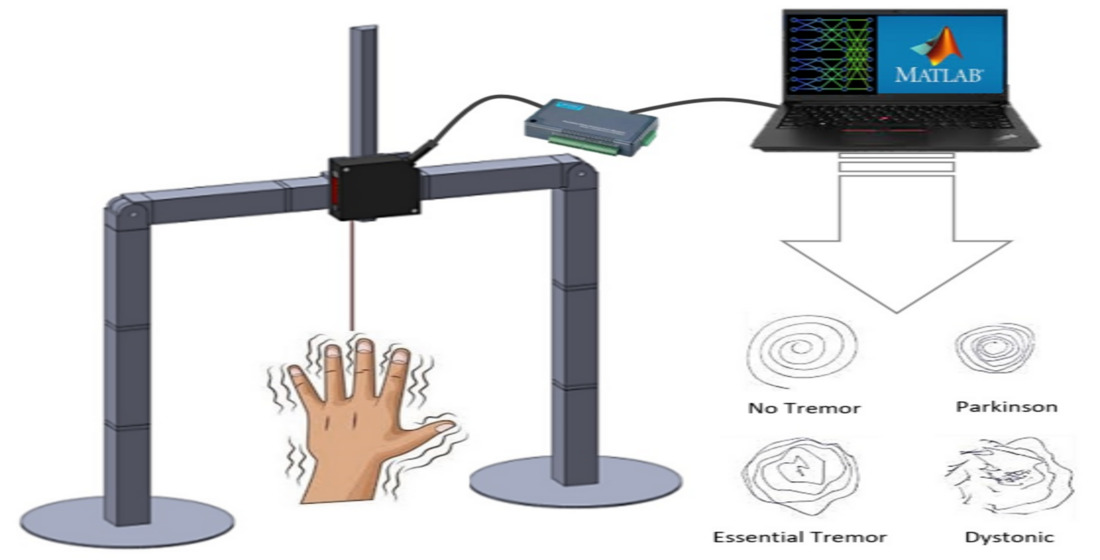 Actuators | Free Full-Text | A Portable Non-Contact Tremor Vibration ...