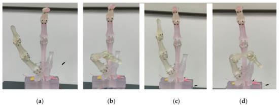 A Design of Biomimetic Prosthetic Hand
