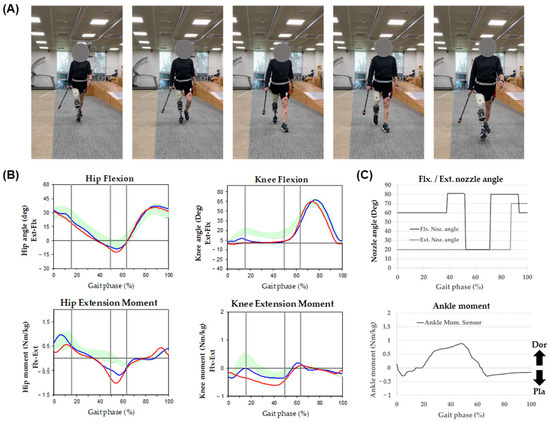 Selective Passive/Active Switchable Knee Prosthesis Based on ...