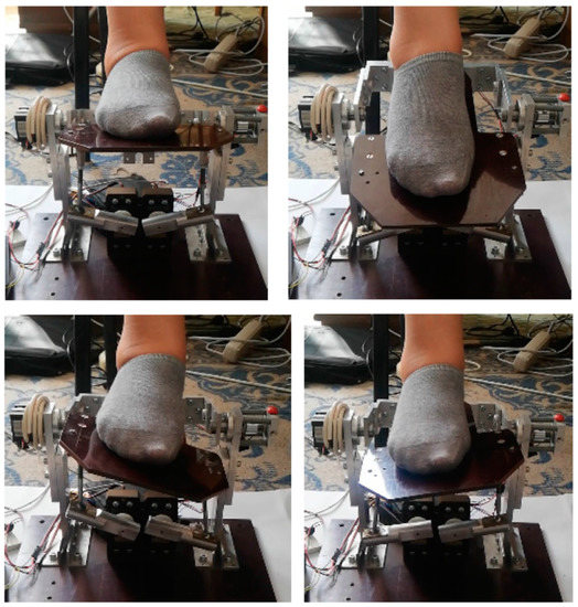 Design and Experimental Testing of an Ankle Rehabilitation Robot