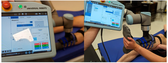 Analysis of the Possibility of Using the UR10e Cobot in Neurological ...