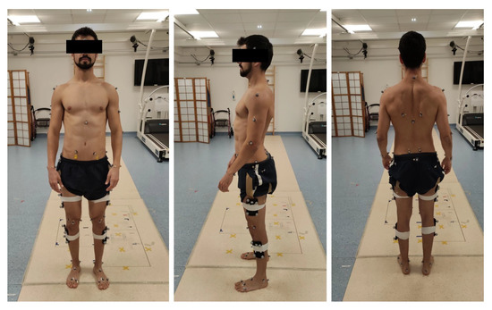 Closed-Loop FES Control of a Hybrid Exoskeleton during Sit-to-Stand ...