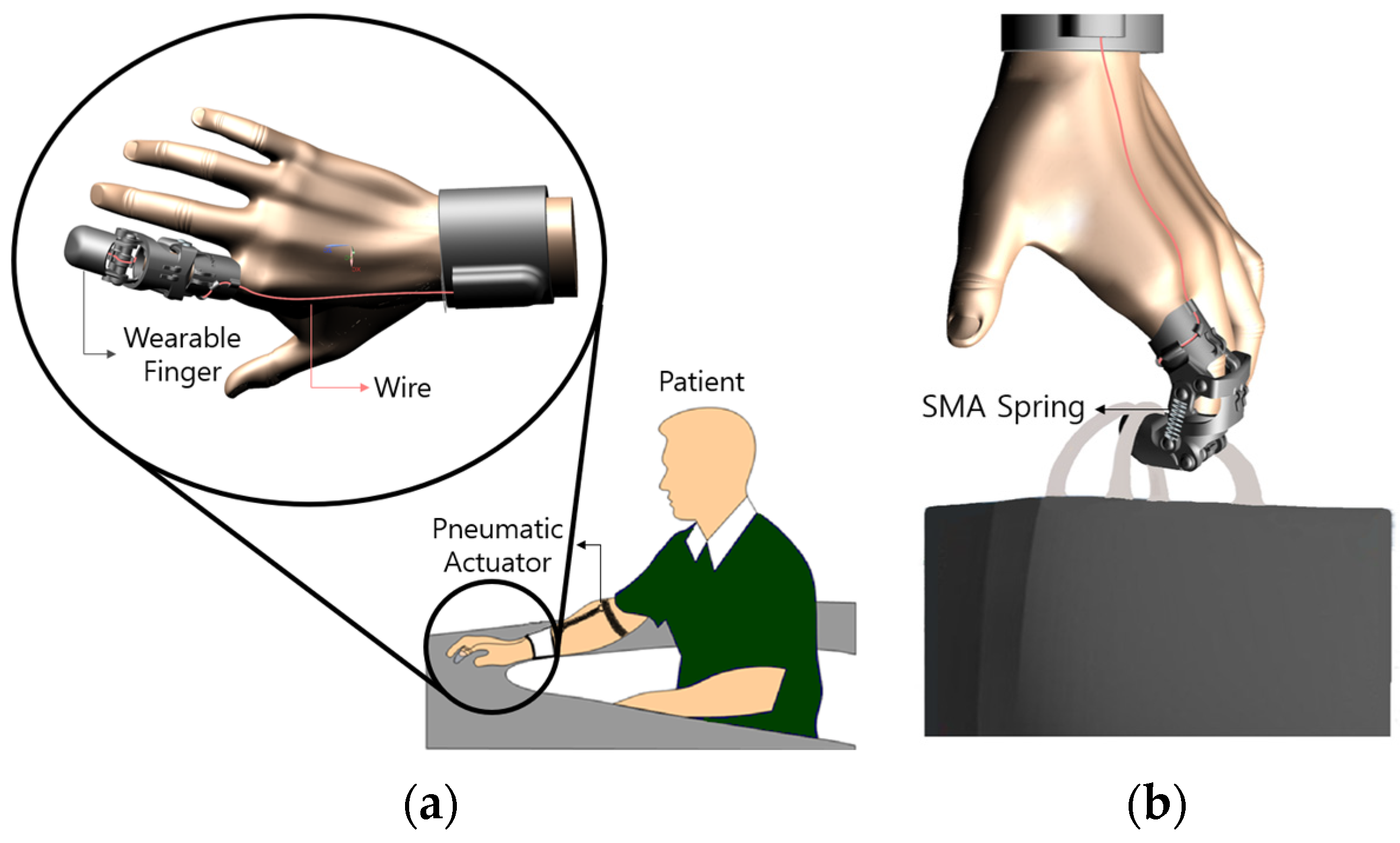 Development of Wearable Finger Prosthesis with Pneumatic Actuator for Patients with Partial ...