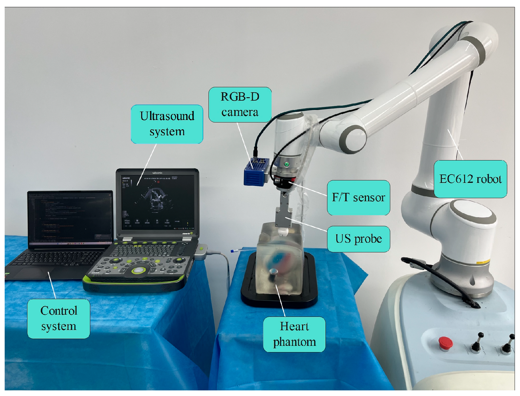Force Tracking Control Method for Robotic Ultrasound Scanning System ...