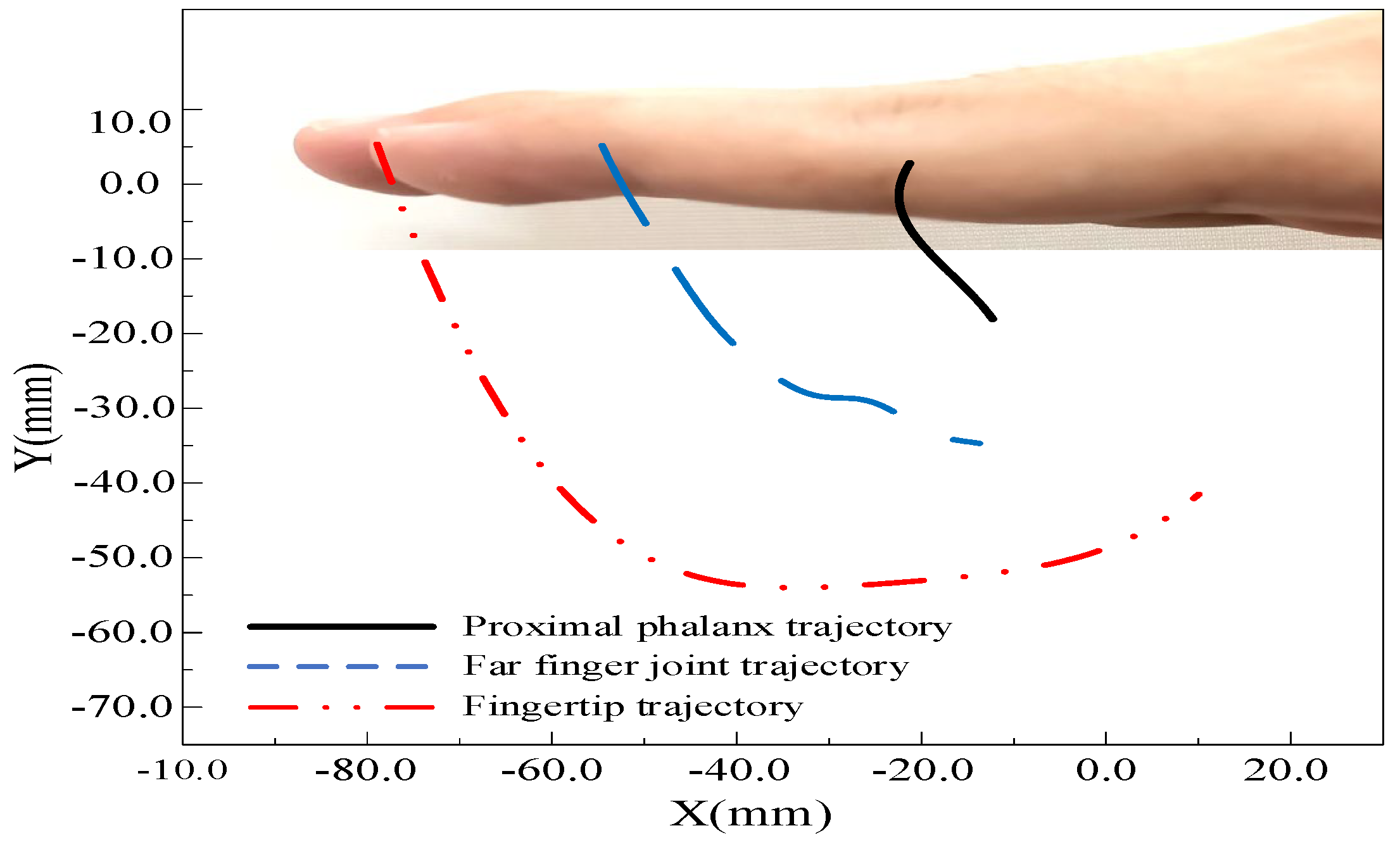 Finger Multi-Joint Trajectory Measurement and Kinematics Analysis Based on Machine Vision