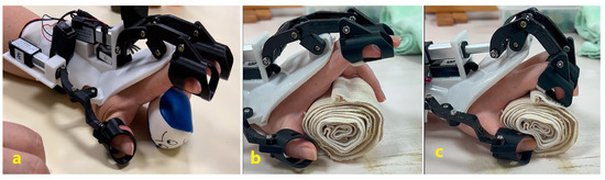 Effectiveness of Powered Hand Exoskeleton on Upper Extremity Function ...