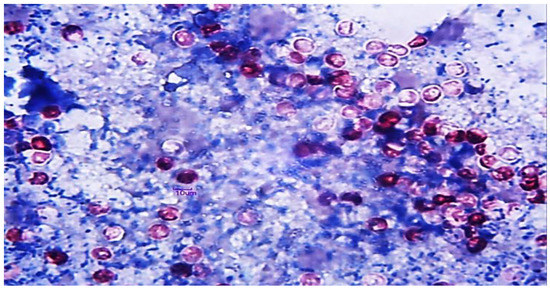 Assessment of the Immune Response of Clinically Infected Calves to ...