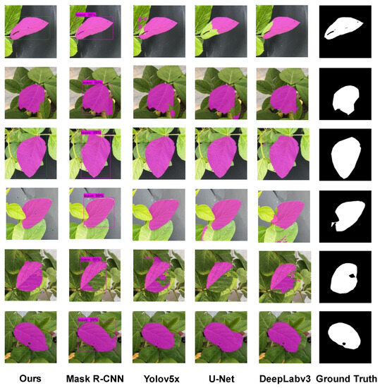 Target Soybean Leaf Segmentation Model Based on Leaf Localization and Guided Segmentation