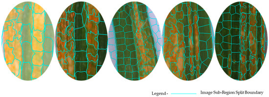 Research on the Method of Identifying the Severity of Wheat Stripe Rust Based on Machine Vision