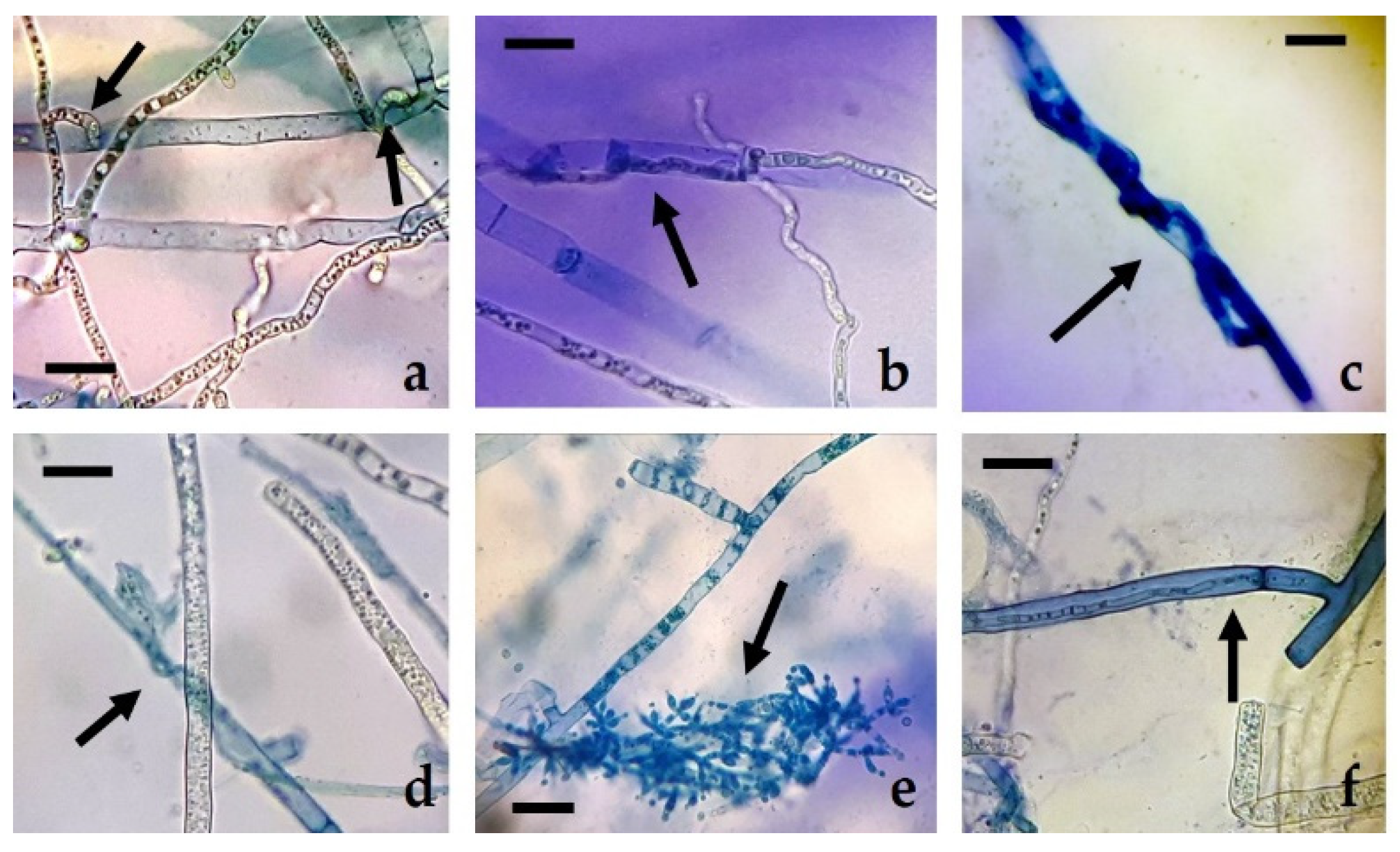 Agronomy | Free Full-Text | Potential of Native Trichoderma Strains as ...