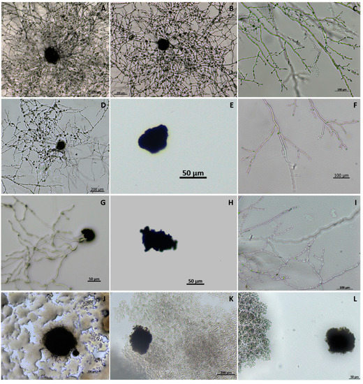 Biocontrol of Macrophomina phaseolina Using Bacillus amyloliquefaciens ...