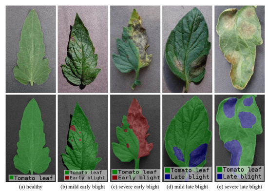 DS-DETR: A Model for Tomato Leaf Disease Segmentation and Damage Evaluation