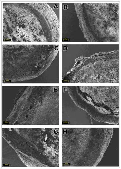Optimization of Fluidized-Bed Process Parameters for Coating Uniformity ...