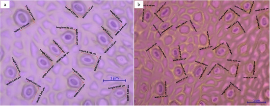 Production of Triploid Seedless Sweet Orange [Citrus sinensis (L ...