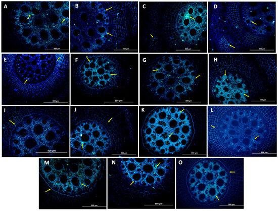 Selection and Characterization of Somaclonal Variants of Prata Banana ...