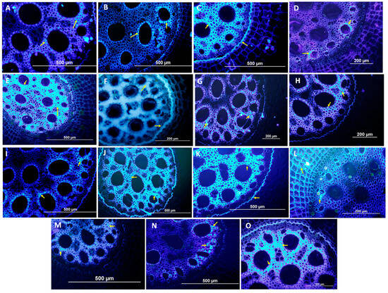 Selection and Characterization of Somaclonal Variants of Prata Banana ...