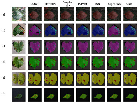 EFS-Former: An Efficient Network for Fruit Tree Leaf Disease Segmentation and Severity Assessment