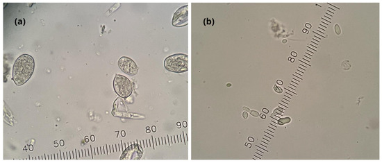 Molecular Detection of the Grapevine Pathogens Plasmopara viticola and ...