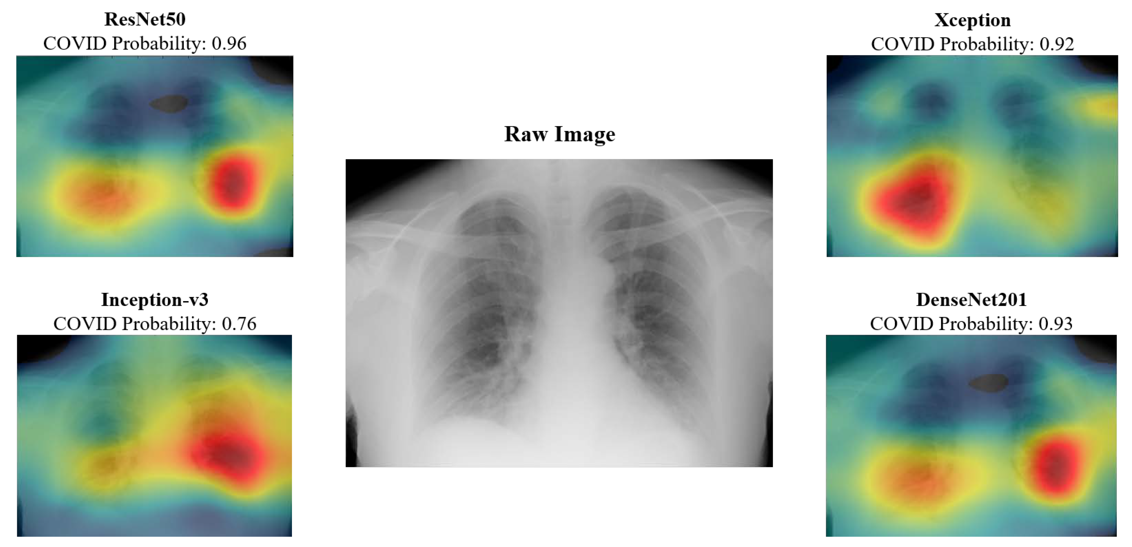 Transfer-to-Transfer Learning Approach for Computer Aided Detection of ...
