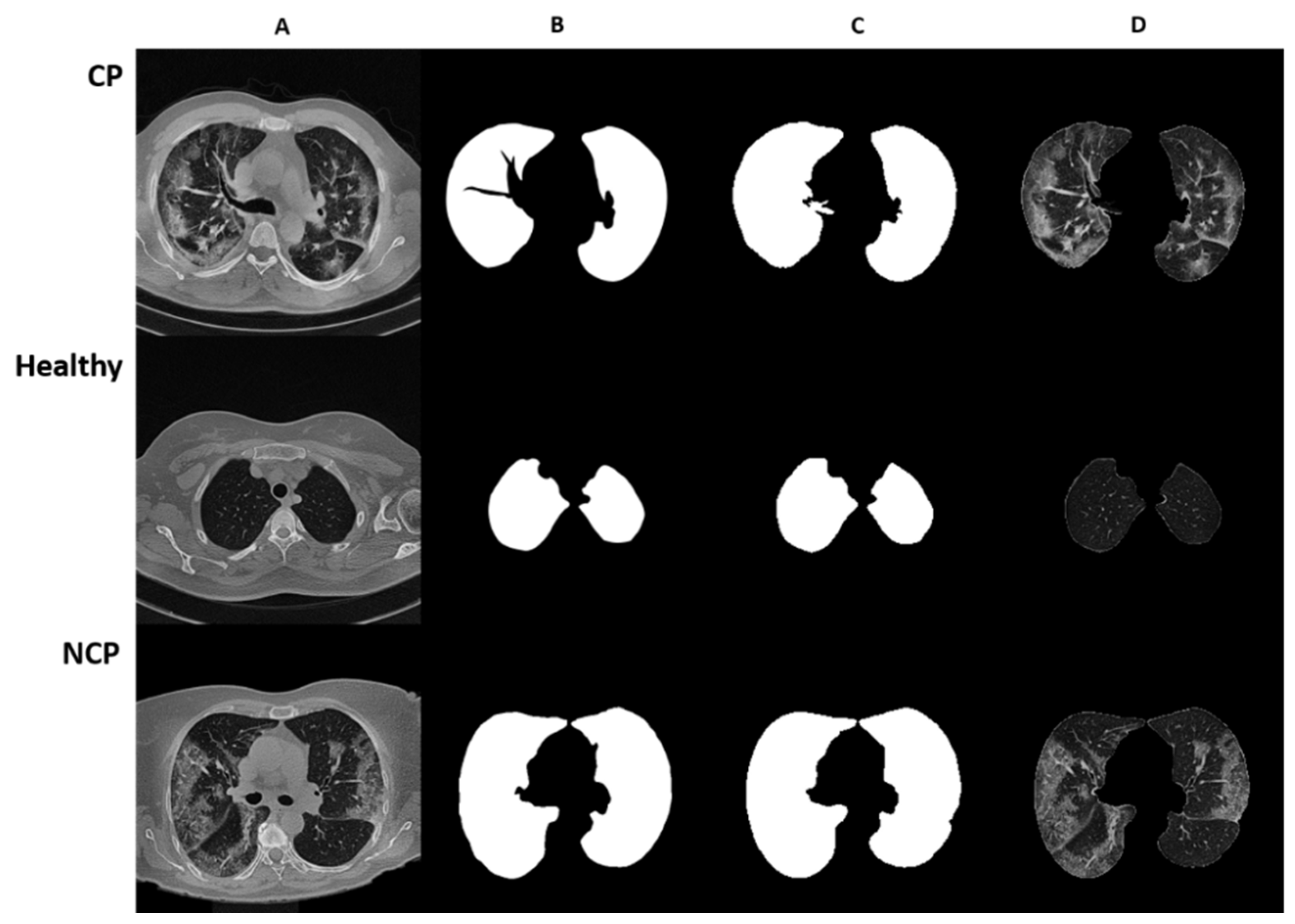 COVID-19 Diagnosis from Chest CT Scans: A Weakly Supervised CNN-LSTM Approach