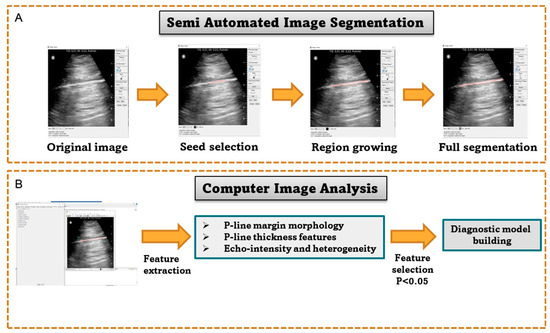 AI | Free Full-Text | Can Artificial Intelligence Aid Diagnosis by ...